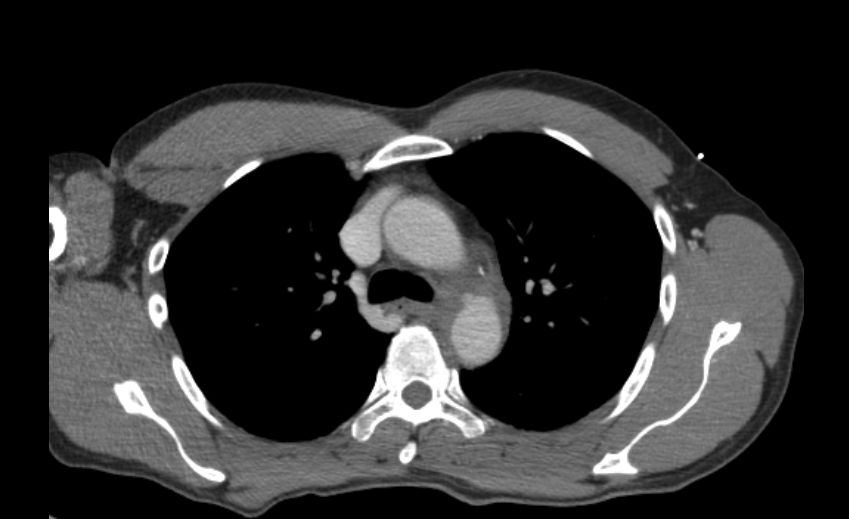 Case Reports | SwissACS (Acute Care Surgery) trauma, critical care ...